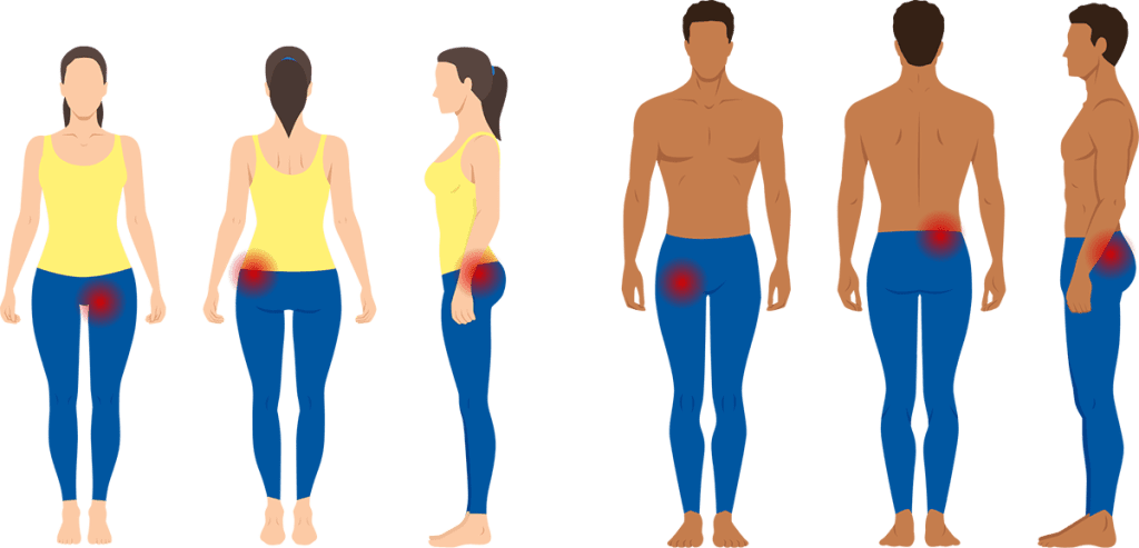 How to Identify the Severity of Your Hip Pain - CORE Orthopedics
